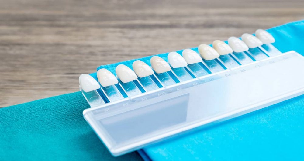 KERAMIČKE FASETE - Dental Oral Centar