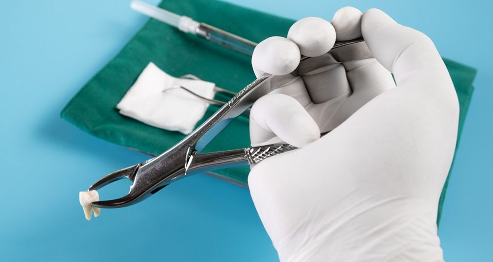 VAĐENJE ZUBA - Dental Oral Centar