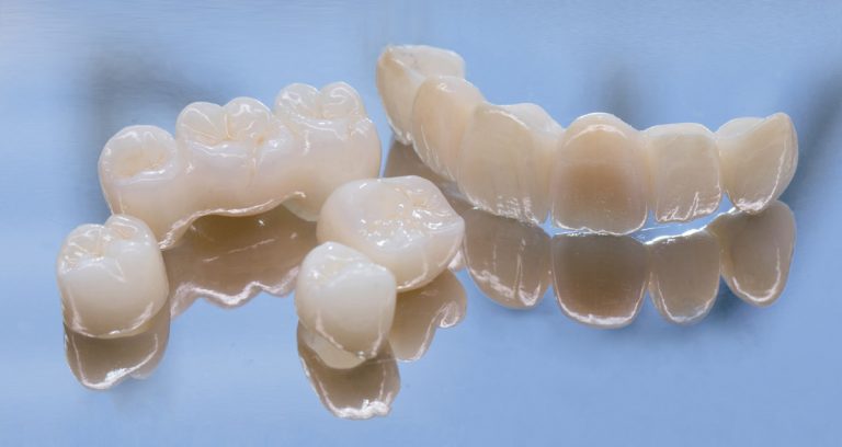 CIRKONIJUM KRUNICE - Dental Oral Centar